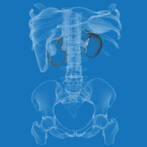 diSplay - The Urology Surgery Simulator by InSimo