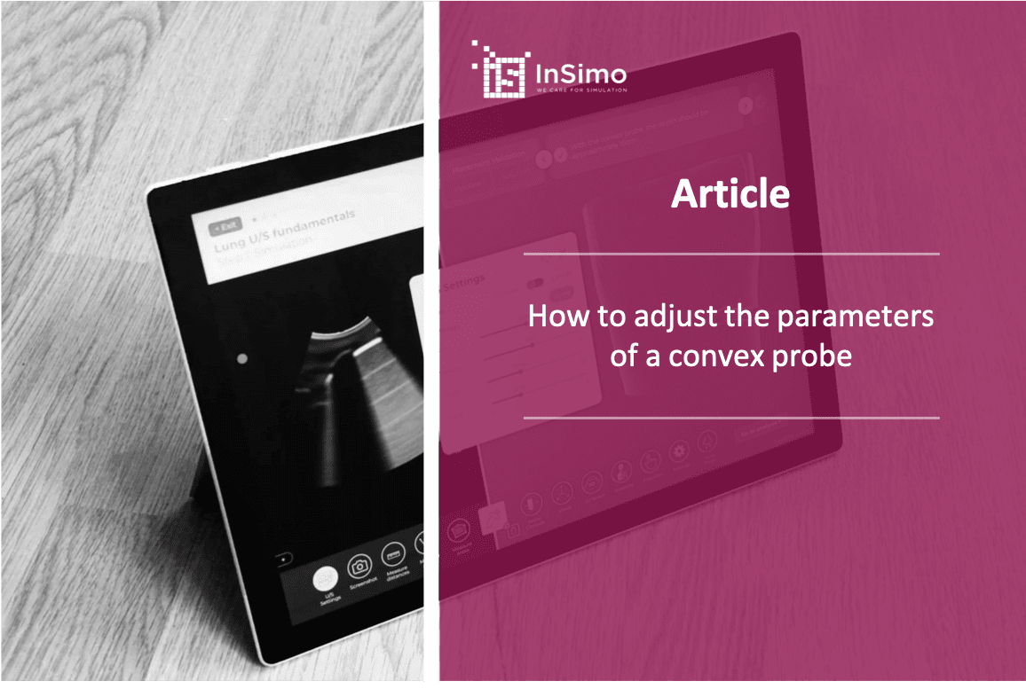 Convex probe parameters for a successful lung ultrasound