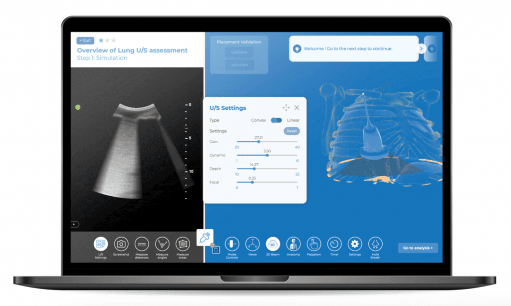 diSplay U/S - Online ultrasound simulator by InSimo