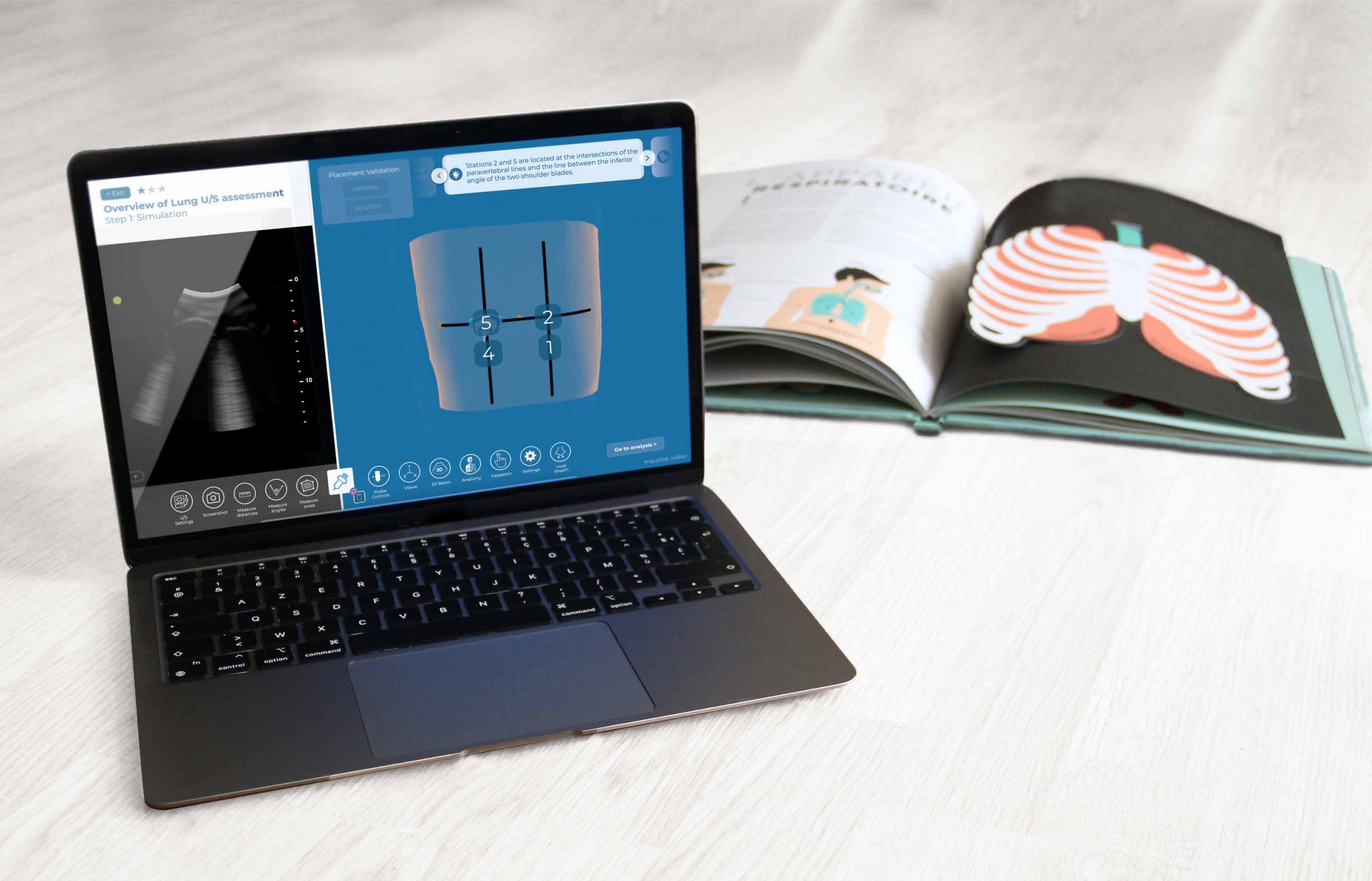 How to successfully perform a lung ultrasound scan using the POCUS protocol?