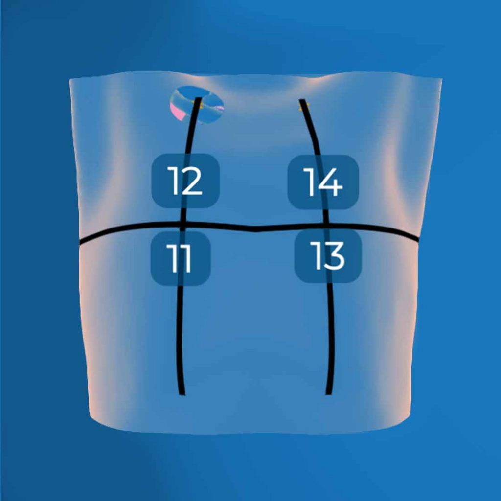 Lung ultrasound using the POCUS protocol