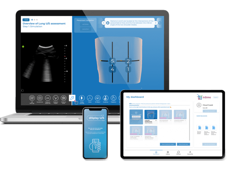 diSplay U/S - Online ultrasound simulator by InSimo
