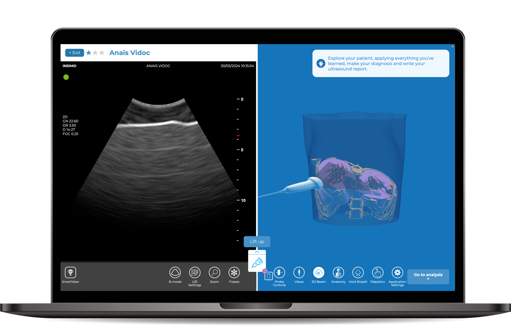 Hands-on ultrasound training, online