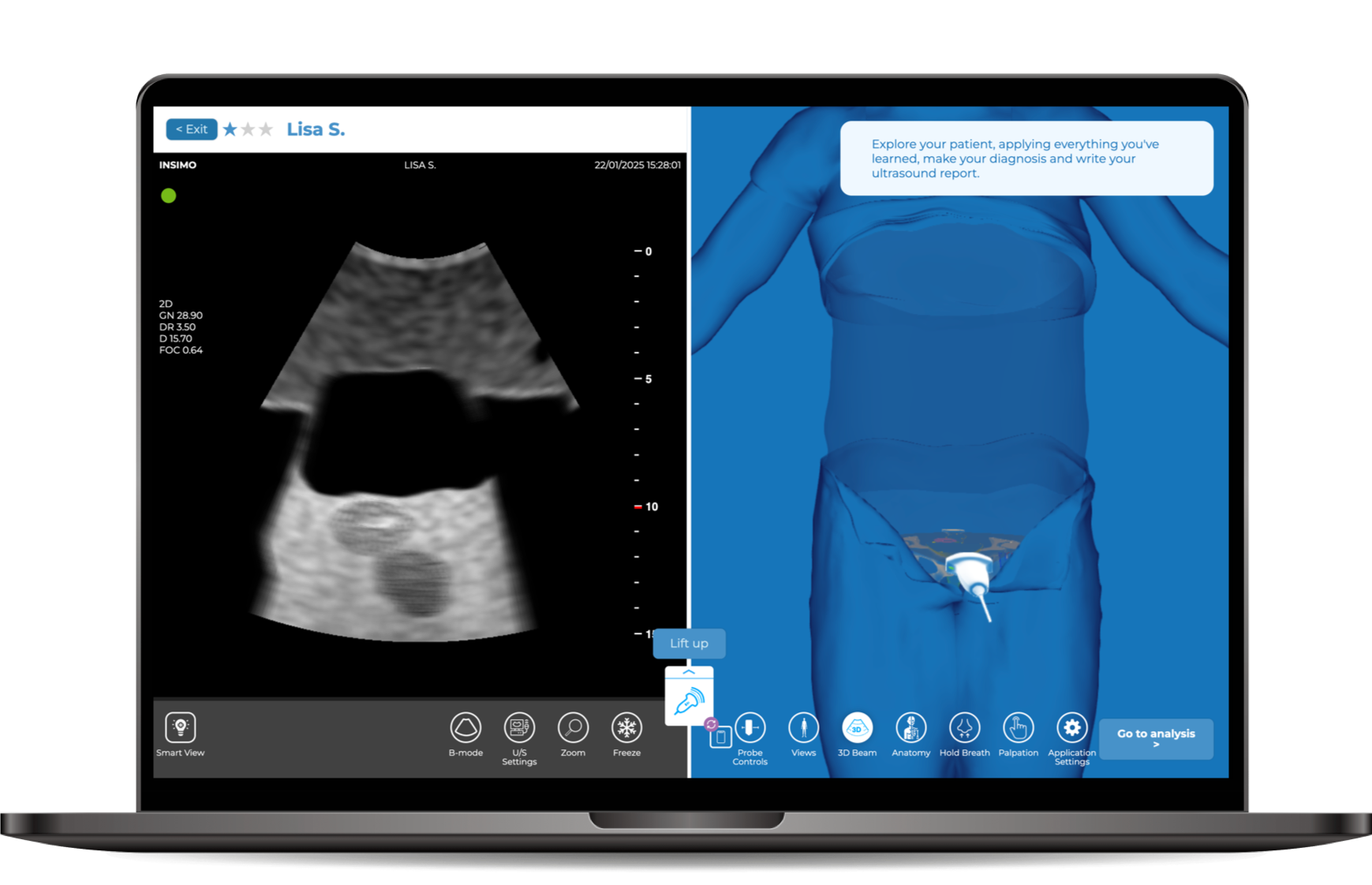 Bladder and Prostate Ultrasound