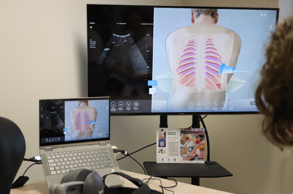 Mastering Pleural Tap: your guide to success